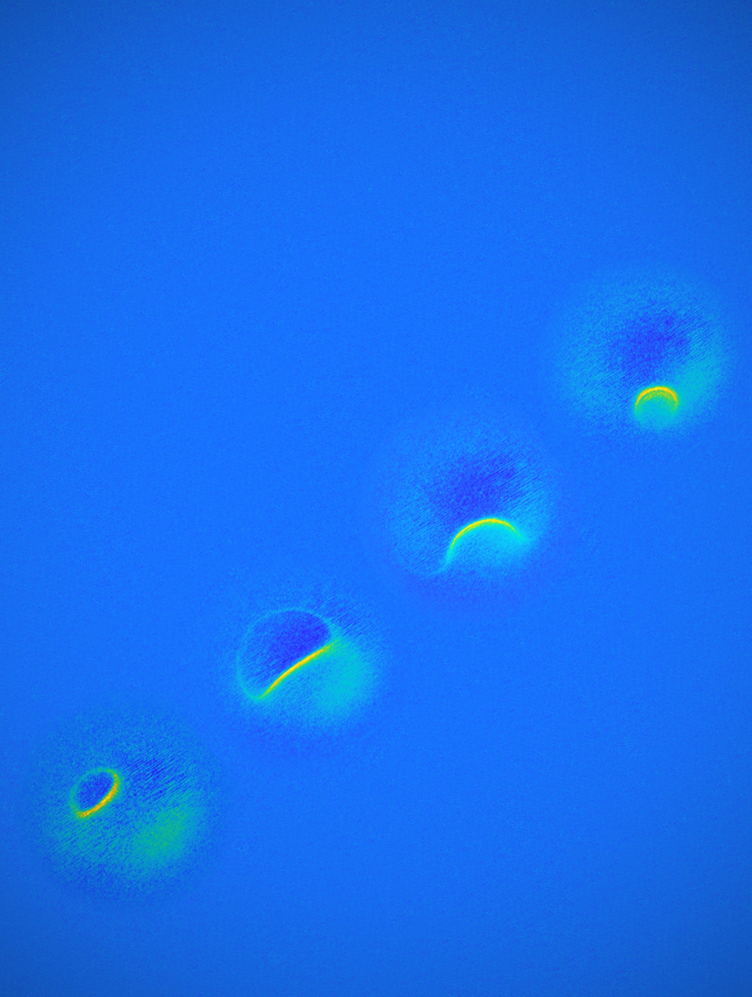 Scientists are now able to take an MRI Scan of an atom – It's Interesting